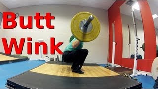 The Physio Detective Butt Winking? One Solution Is To Open Up The Back ...