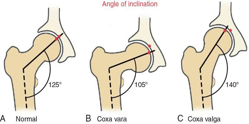 The ITB - 5 things you probably haven't thought about doing to help it ...
